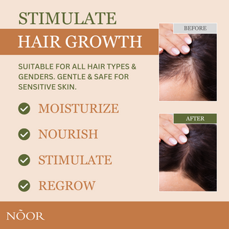 Rosemary Growth Spray – Noor Hair