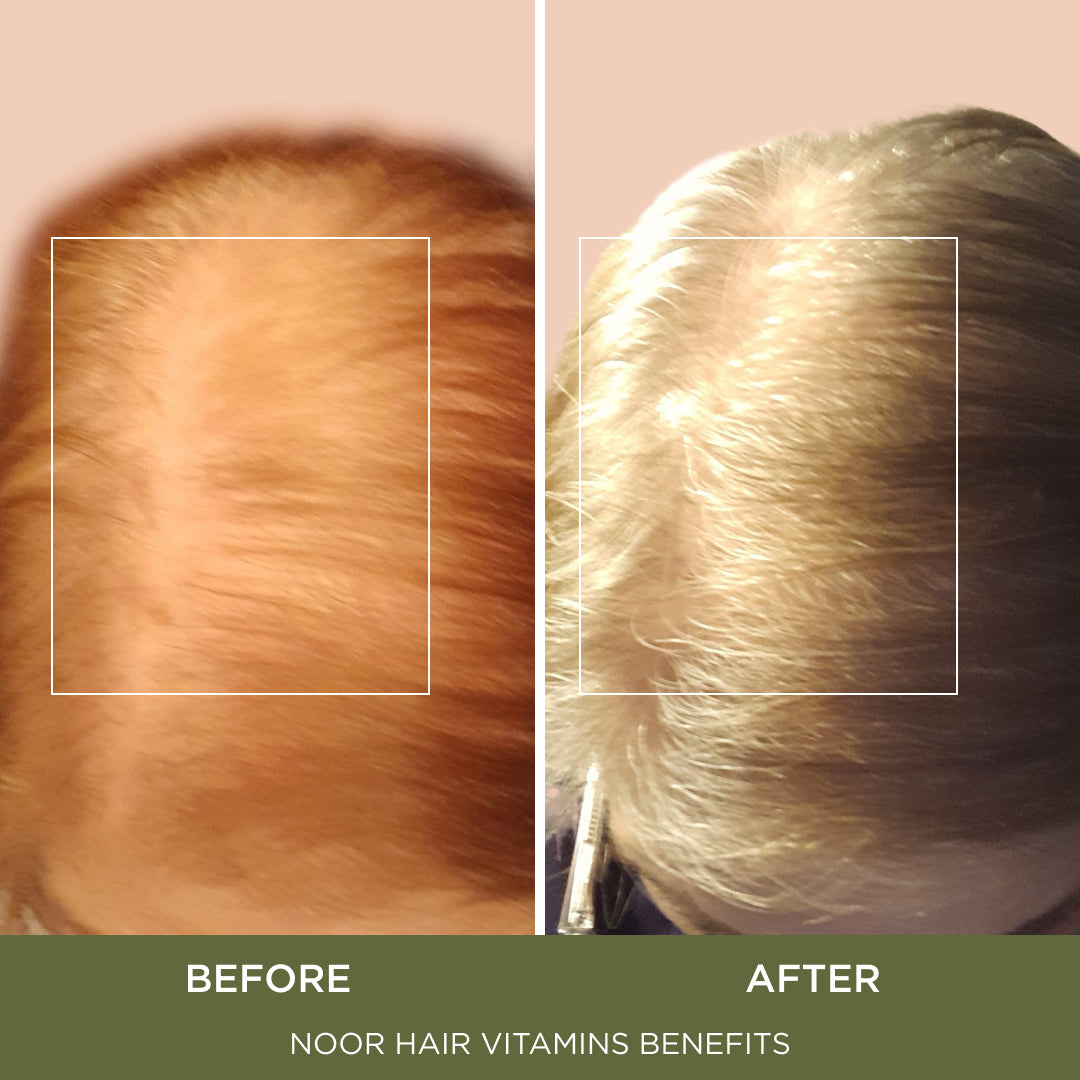 Healthy Hair Formula | Noor Hair Official