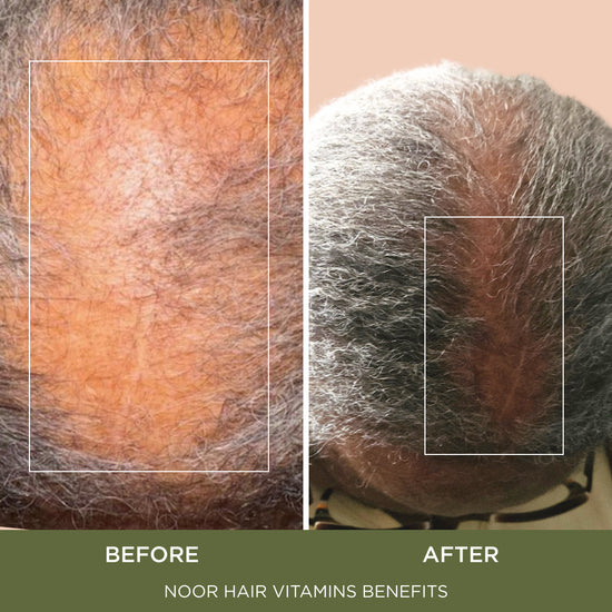 Healthy Hair Formula | Noor Hair Official
