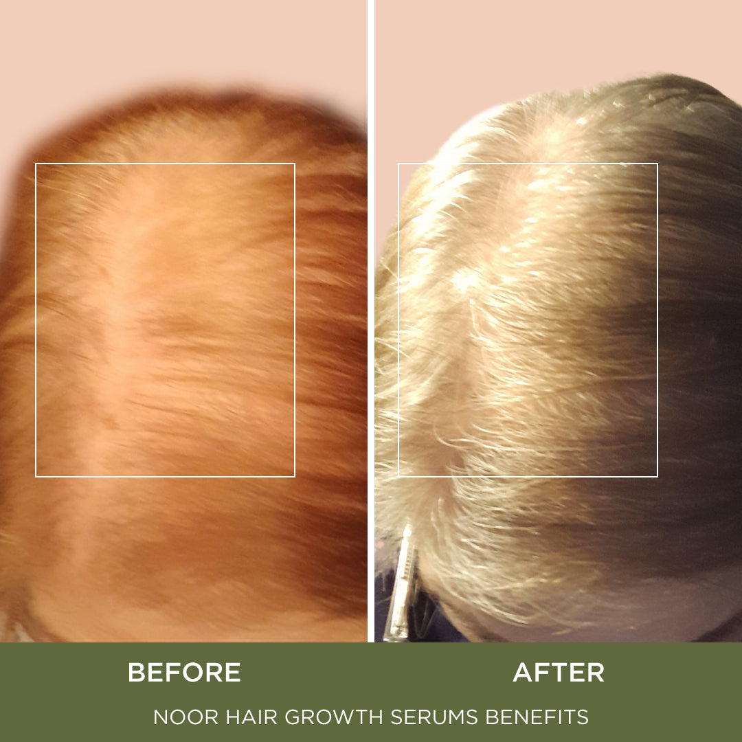 Wonder Growth Spray – Noor Hair